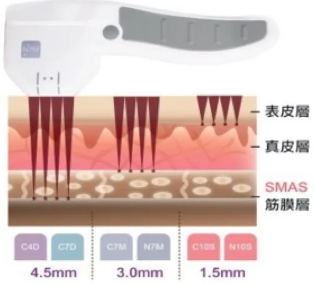 UTIMS HIFU 音波拉提 | Lumas